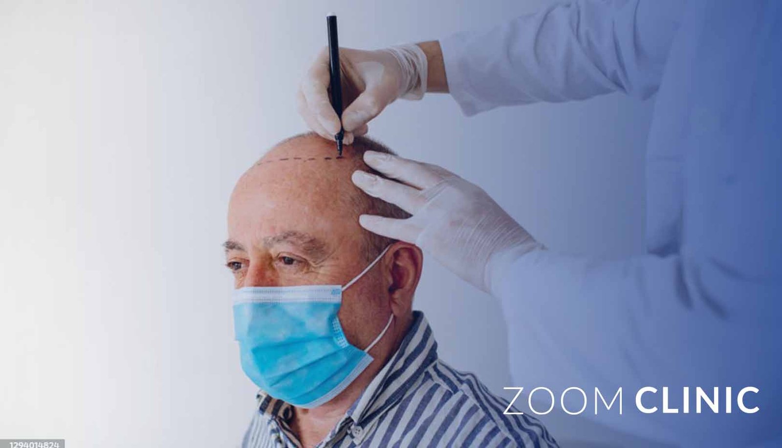 Direct Hair Implantation DHI Precision and Excellence in Hair ...