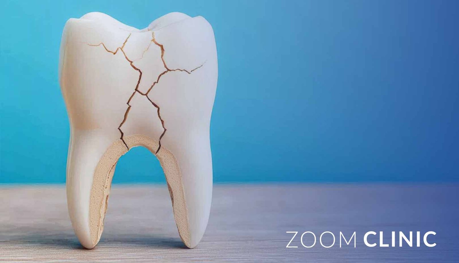 Cracking Teeth: Causes, Symptoms, and Treatment - Zoom Clinic for ...