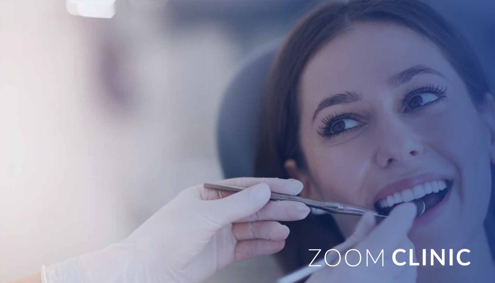 Hollywood Smile Installation Without Shaving or Filing: The Ultimate ...