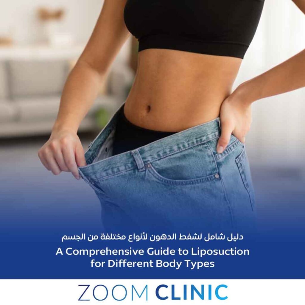A Comprehensive Guide to Liposuction for Different Body Types - Zoom ...