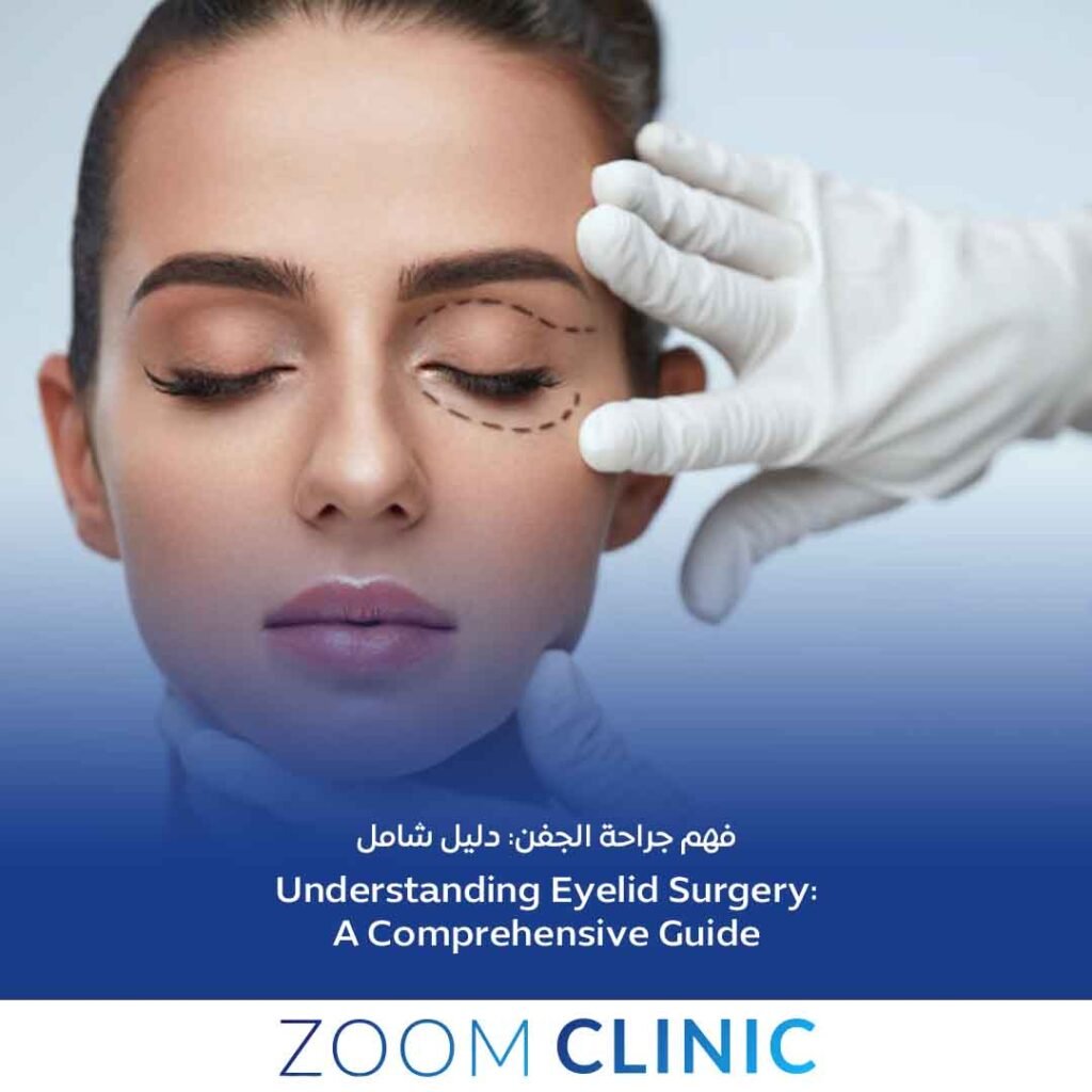 The Definitive Guide To Eyelid Surgery – JCDAT